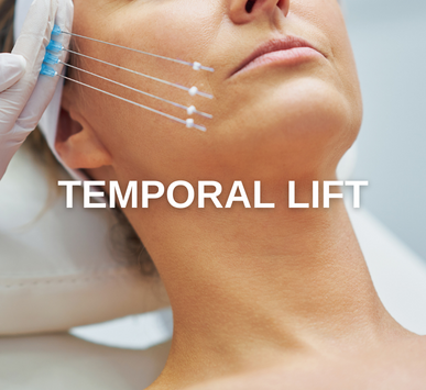 Temporal Lift - Trawellmed